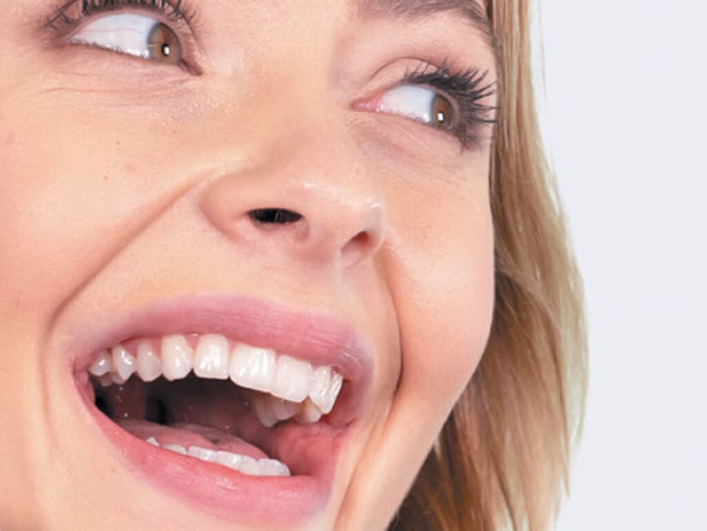 Treatments - The Fabulous Smile Company